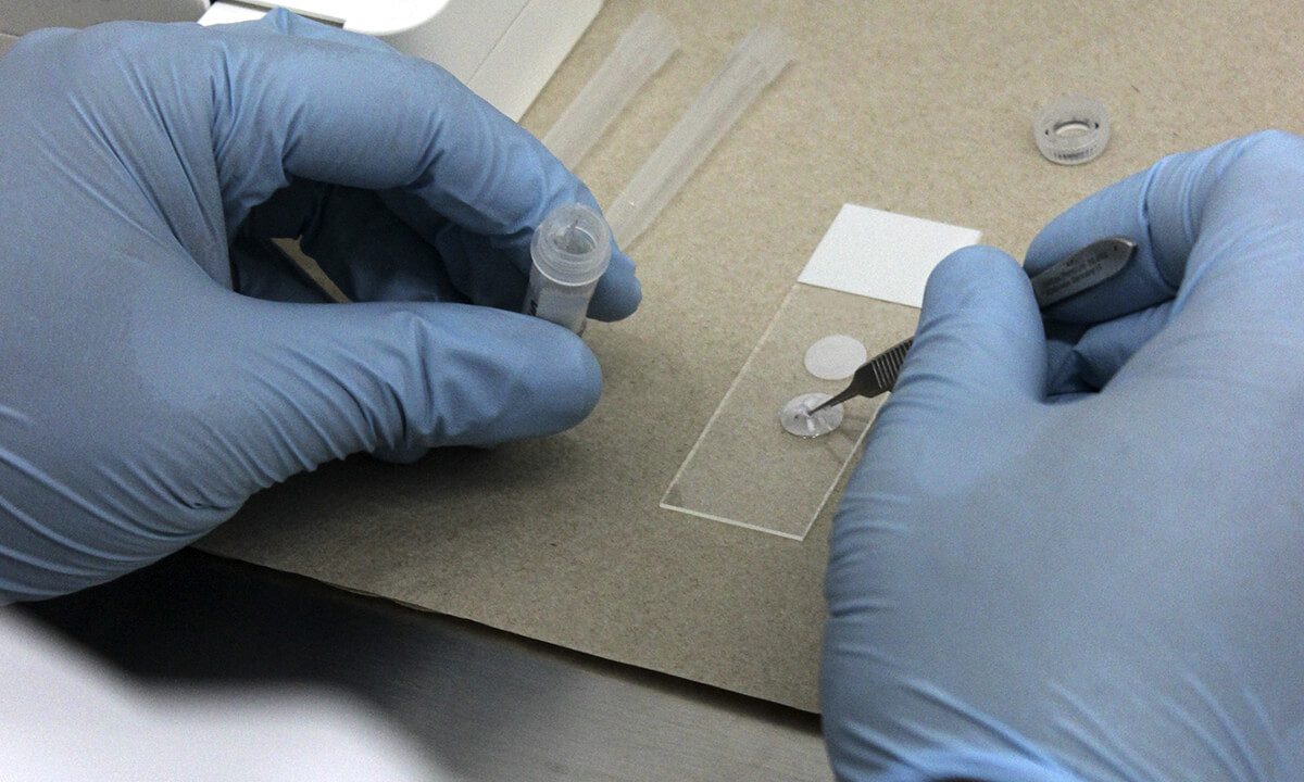 Pathology Service | Fundación Valle del Lili's service.