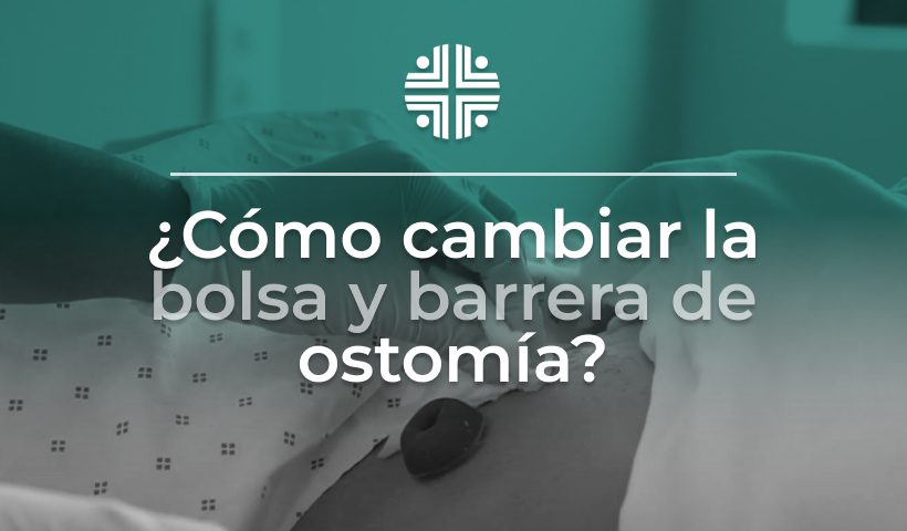 ¿Cómo cambiar la bolsa y barrera de ostomía? - Fundación Valle del Lili